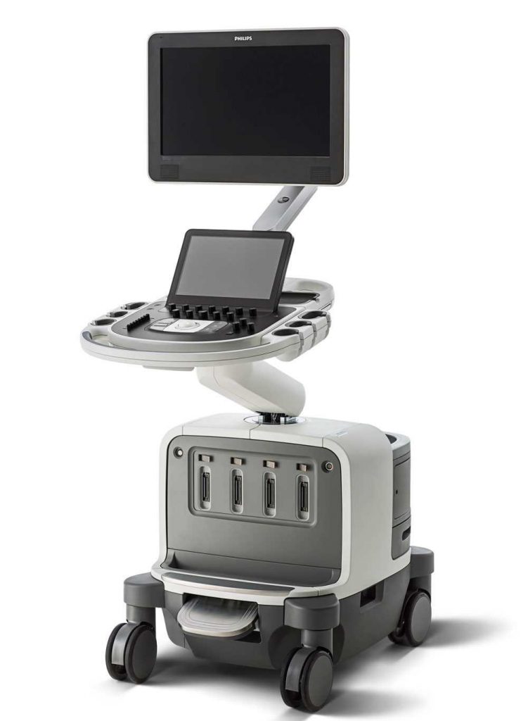 Used Philips CX50 Cardiac Ultrasound - Strata Imaging